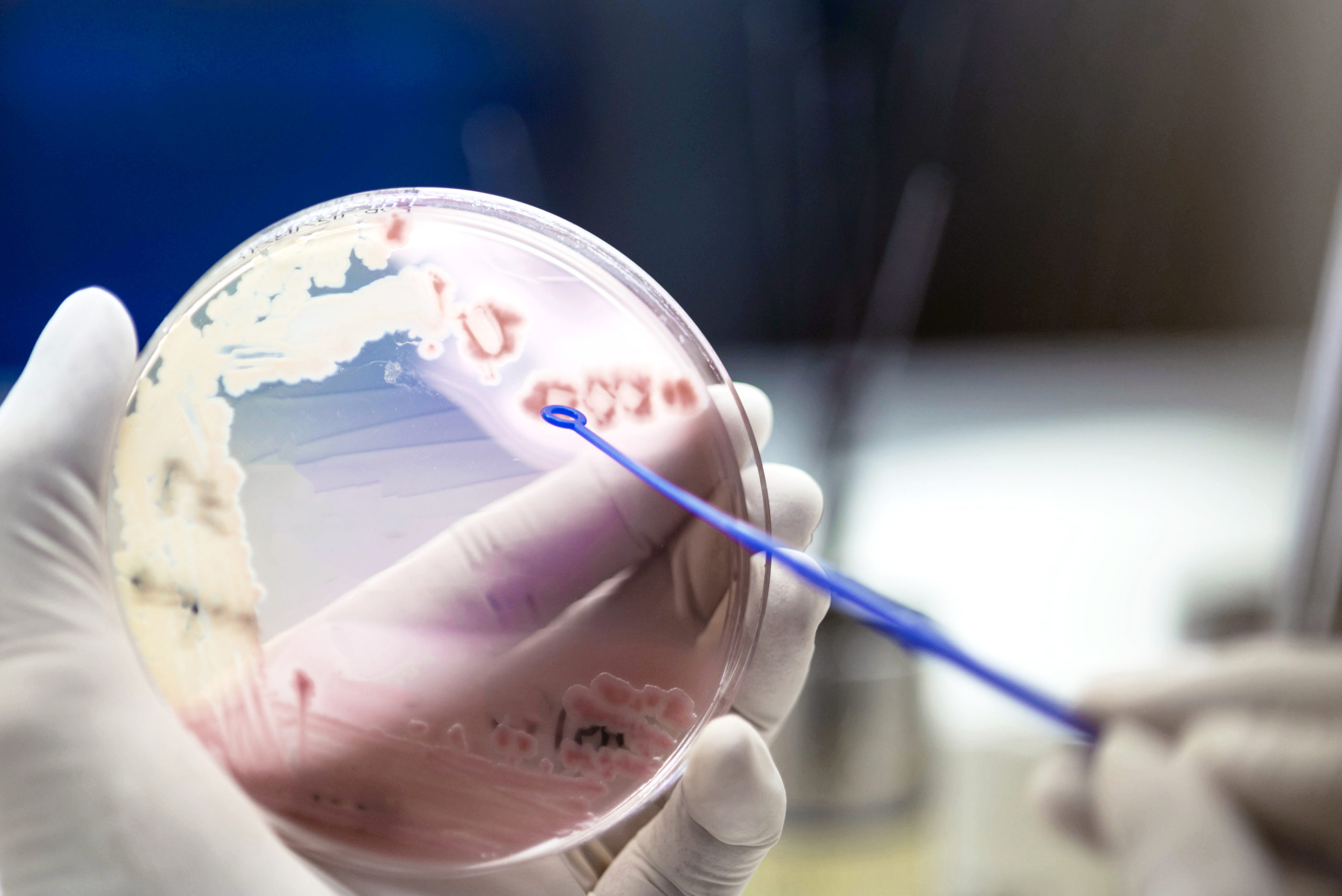 Ancient Microbe Resistance • Darwin, Then and Now